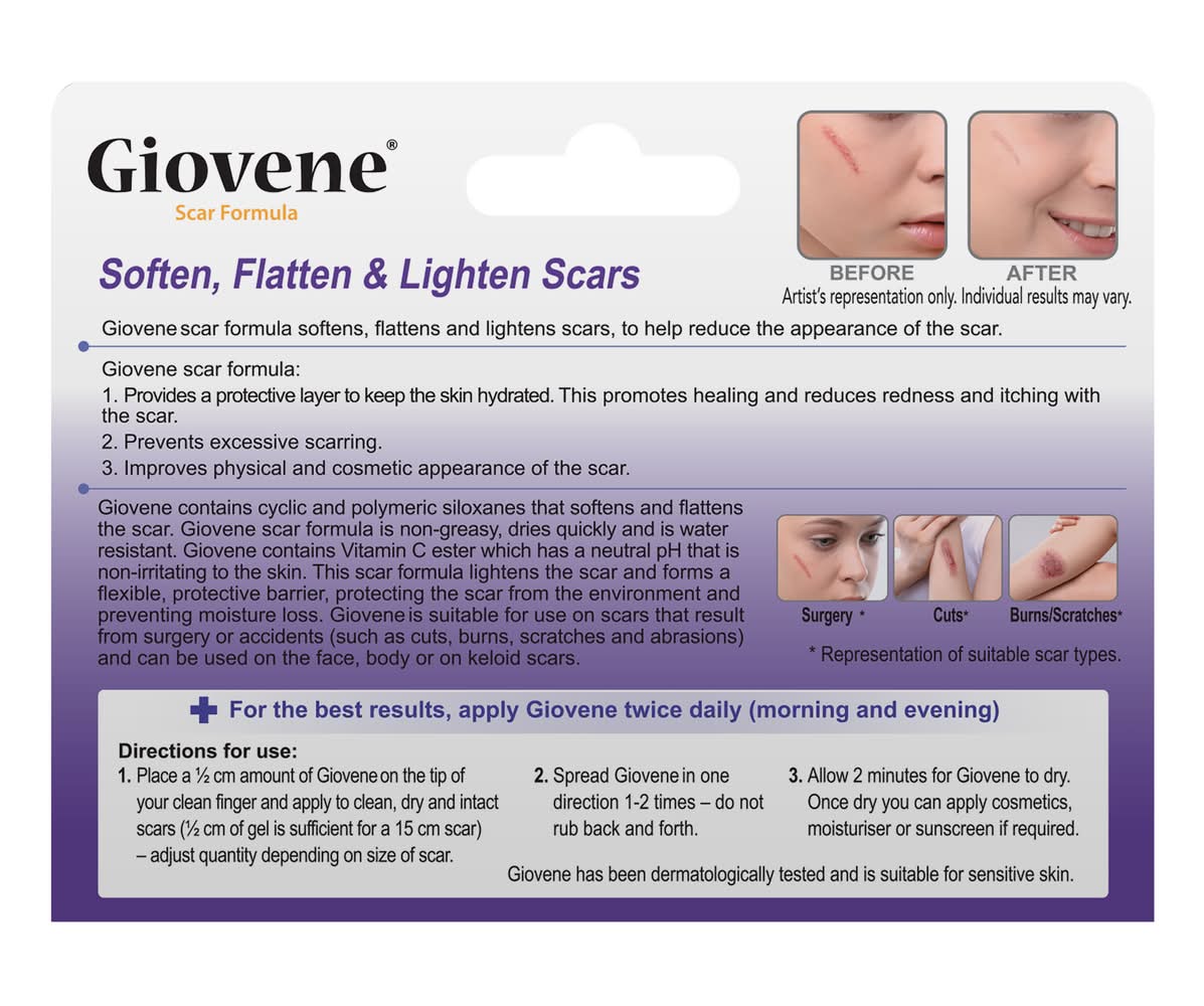 Giovene Specialised Scar Formula Gel Delivery Near Me | Order Online ...